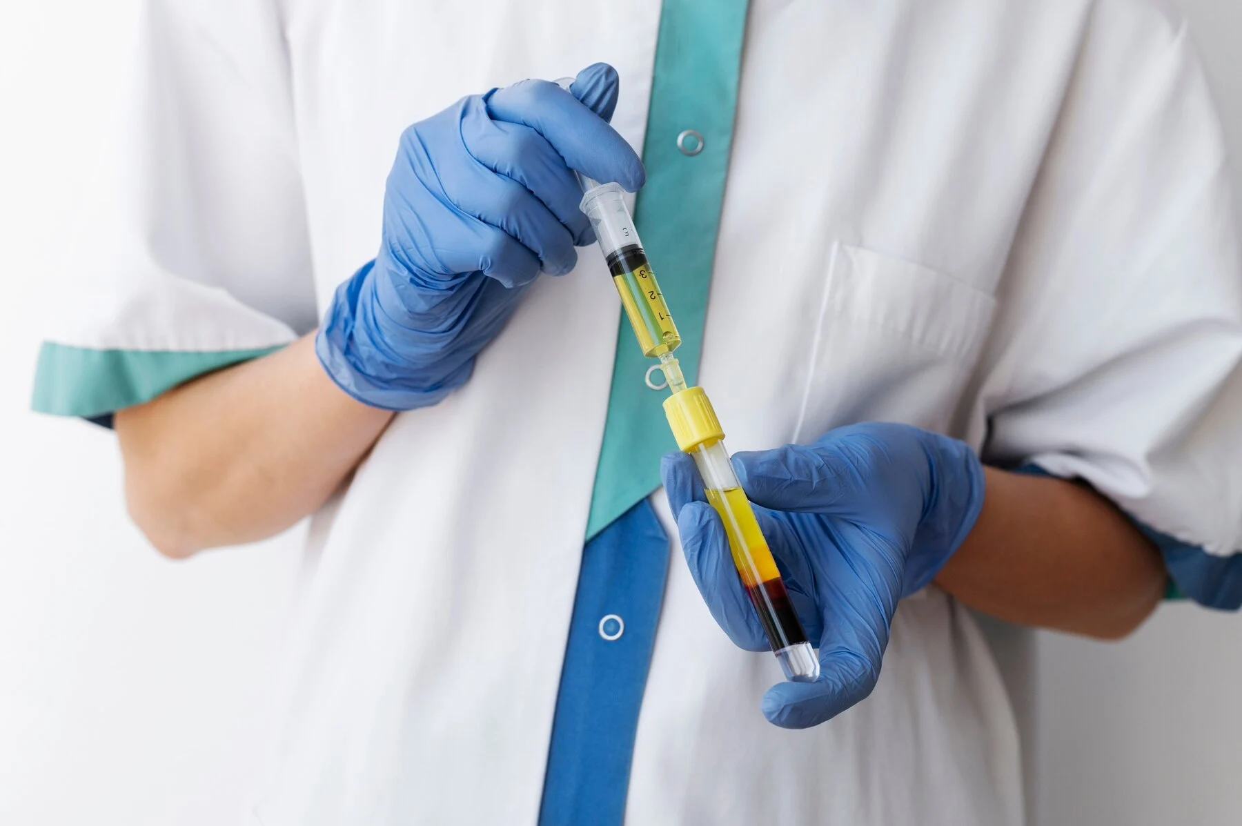 Understanding PRP Therapy: How It Works and What It Does. - Face Lab